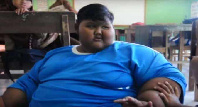 World's heaviest kid, 10-year-old from Indonesia weighs 190 kg due to ...