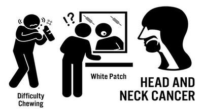 7 common symptoms of head and neck cancer | TheHealthSite.com