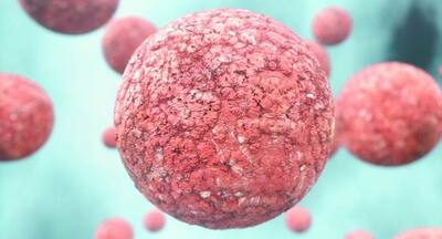 iPhone-based portable ultrasound machine can help detect cancer easily ...