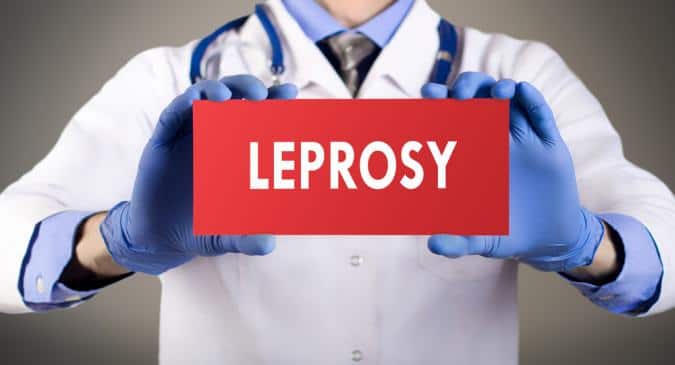 All you need to know about leprosy | TheHealthSite.com
