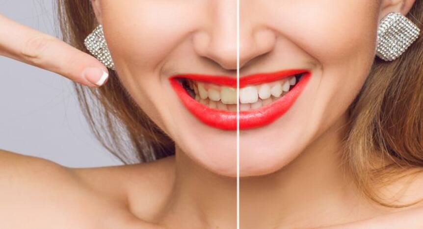 4 oral care mistakes responsible for yellow teeth | TheHealthSite.com