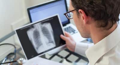 World TB Day: 10 Faqs on tuberculosis answered by an expert ...