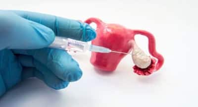 All you need to know about assisted reproductive technology or ART ...