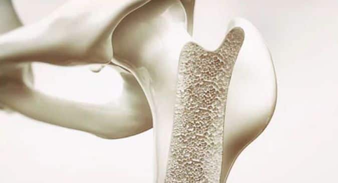 Probiotics can help increase bone density, says study | TheHealthSite.com