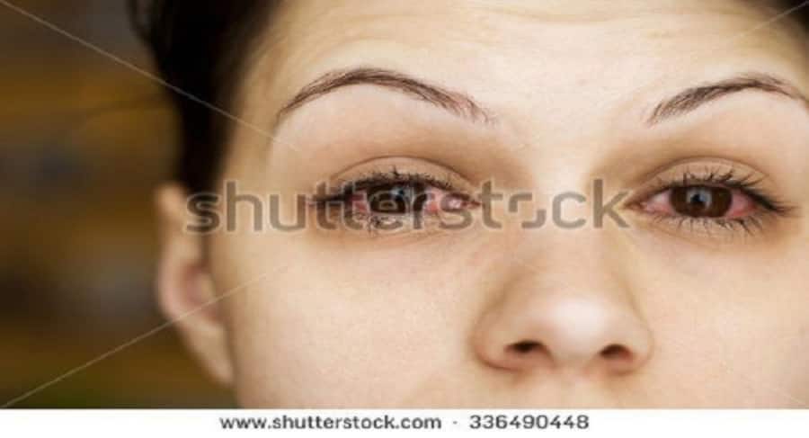 Not just lungs, tuberculosis affects your eyes as well | TheHealthSite.com