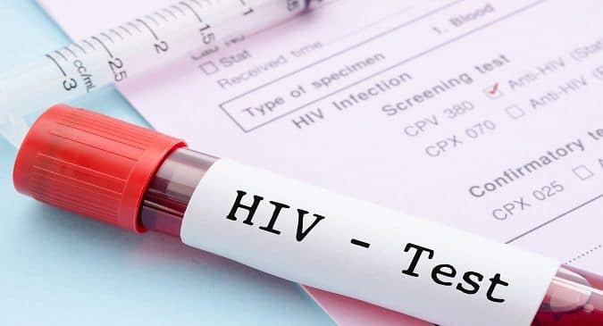 Did you know? This new HIV therapy can boost immunity | TheHealthSite.com