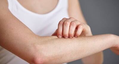 All you need to know about Scleroderma | TheHealthSite.com