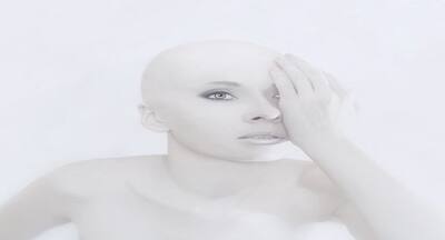 Face transplant: All you need to know about this rare procedure ...