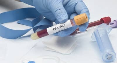 What to do if your PSA levels are high? | TheHealthSite.com