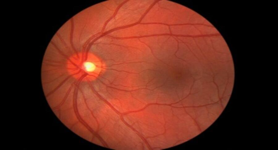 Lab-grown human retina tissues can pave way for new therapies for ...