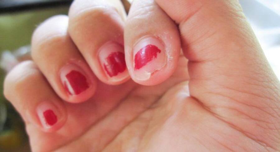 Know how to take care of your fingernails | TheHealthSite.com