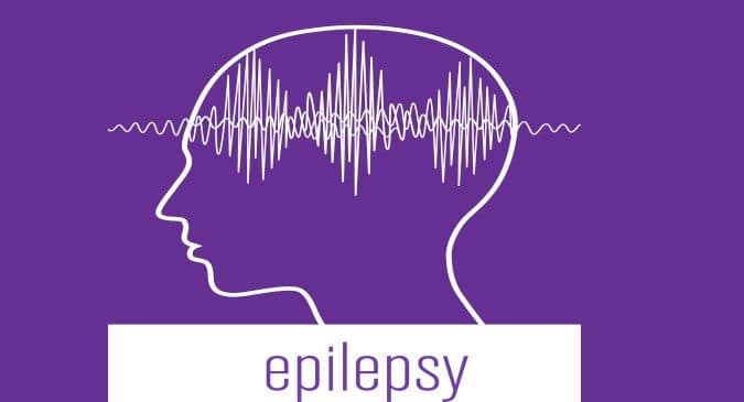 Epilepsy can be treated with advanced robotic surgery now ...