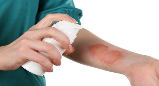 What Is Burns Types Of Burn Home Remes Thehealthsite Com