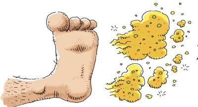 This is how you can get rid of foot odour | TheHealthSite.com