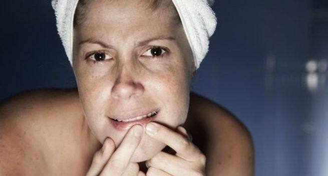 5 basic tips to treat inflammation on the skin | TheHealthSite.com