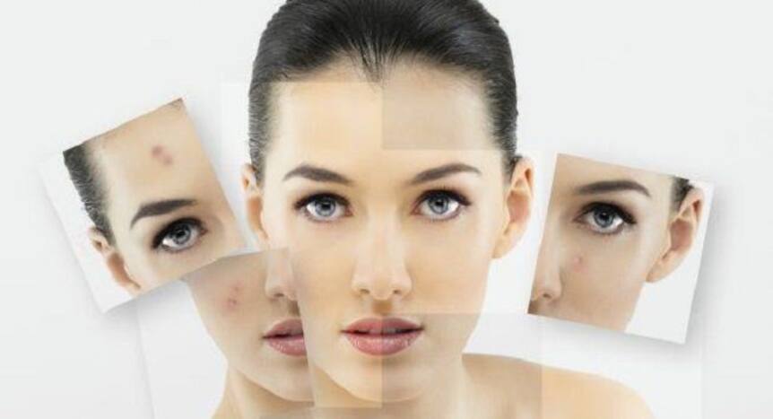 Know about these home remedies to treat dark skin pathces ...