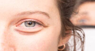 eye cancer - common eye disorders - signs of various eye diseases ...