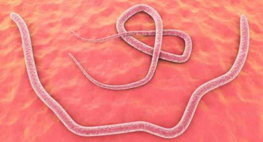 Get rid of your intestinal worms naturally | TheHealthSite.com