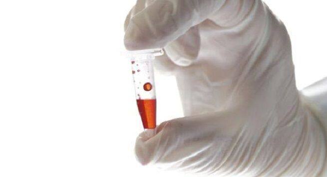 5 preventive measures for Ebola virus disease | TheHealthSite.com