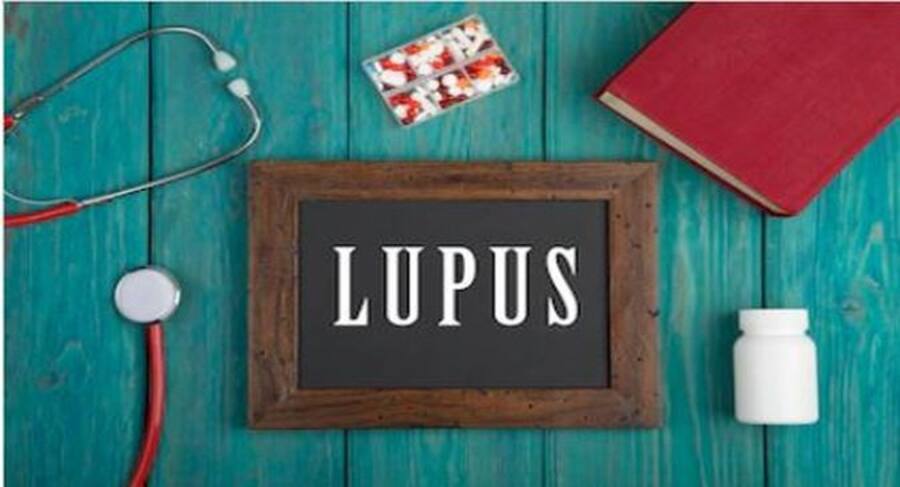 World Lupus Day | Risk Factors Behind SLE | TheHealthSite.com ...