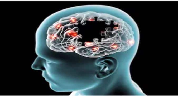 Brain stimulation | brain activity | TheHealthSite.com | TheHealthSite.com