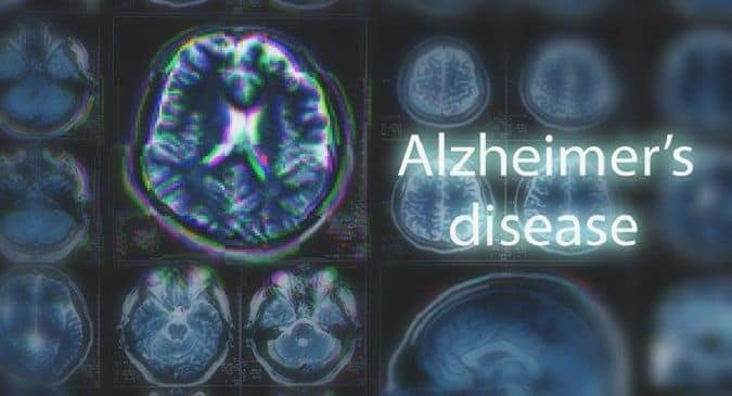Alzheimer's: Protein identified%%page%% %%sep%% TheHealthSite.com ...