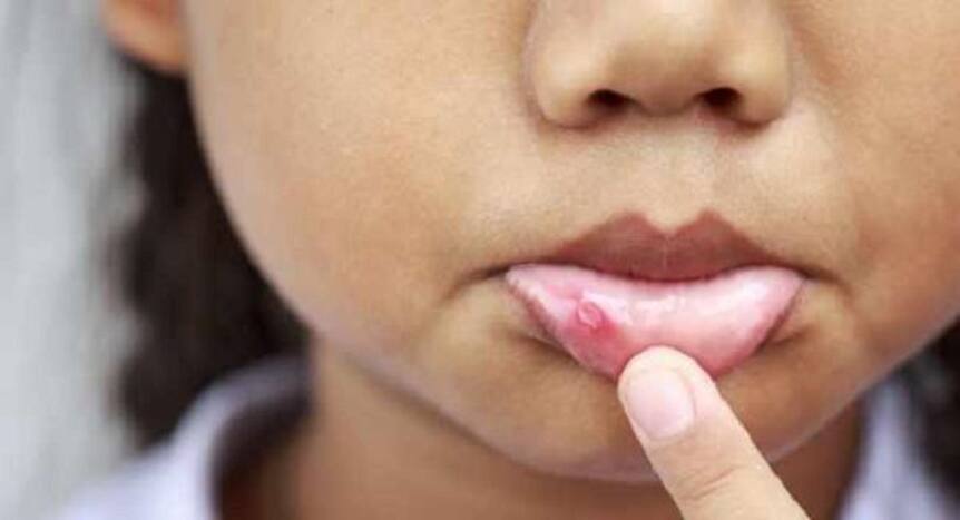 Vitamin B12 deficiency: Complications that may follow with this ...