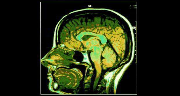 Memory deteriorates quickly in the last two years | TheHealthSite.com