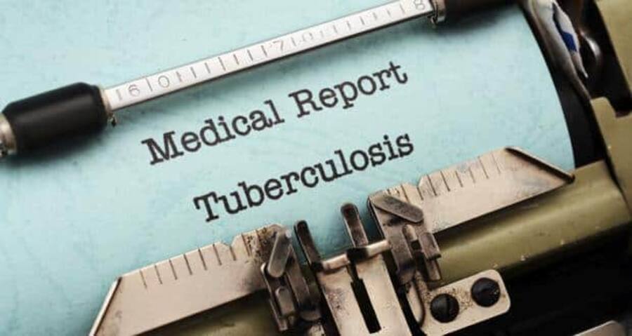 Drug resistant tuberculosis -- causes, types, symptoms, diagnosis ...