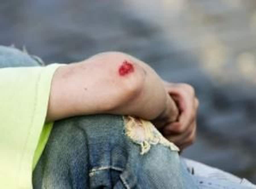You could die of a neglected dirty wound! | TheHealthSite.com