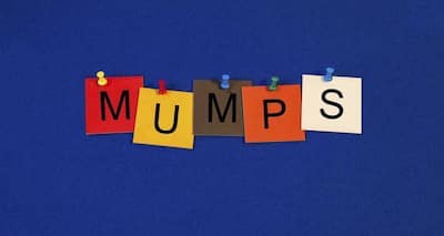 Mumps -- causes, symptoms, diagnosis, treatment and complications ...