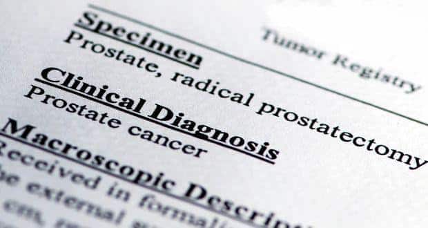 Diagnosis of prostate cancer | TheHealthSite.com