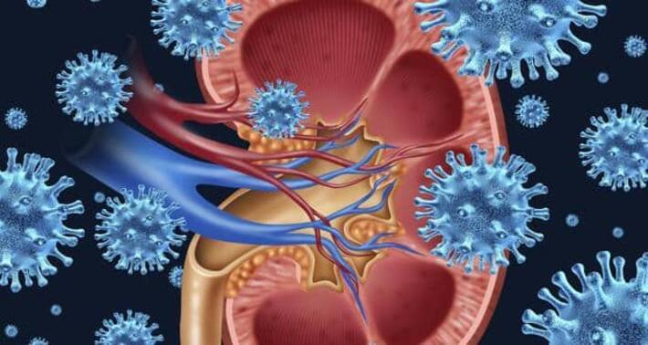 Pyelonephritis or kidney infection – causes, symptoms, diagnosis ...