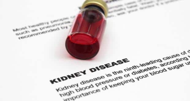 World Kidney Day 2014: 3 good reasons to get a kidney check up done ...