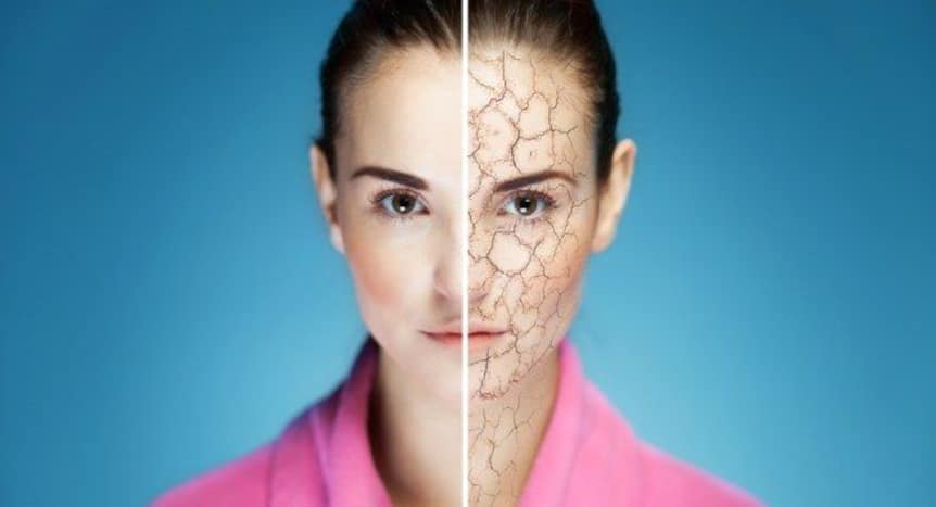 7 foods that may be drying your skin l TheHealthSite.com ...