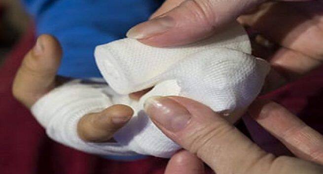 What should you do if a finger gets cut off your hand?