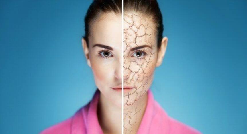 Dry skin treatment: Eat these foods to moisturise your skin from within ...