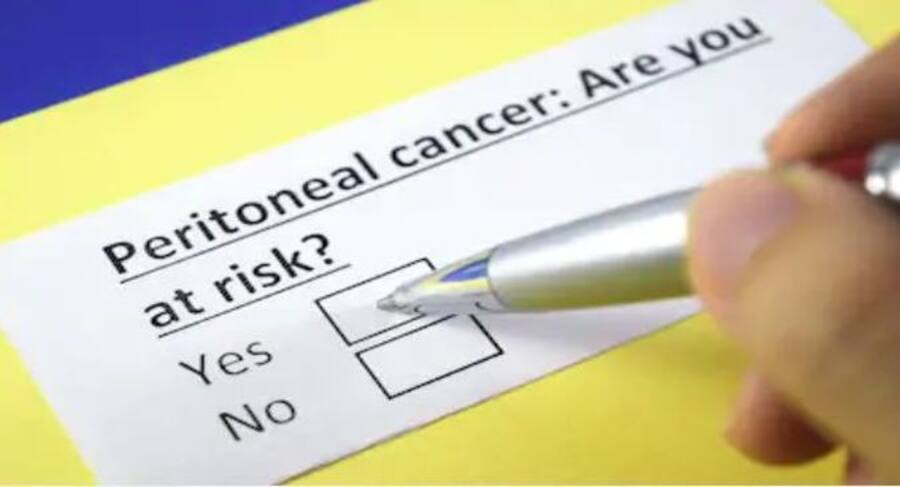 Peritoneal cancer: Know all about it | TheHealthSite.com