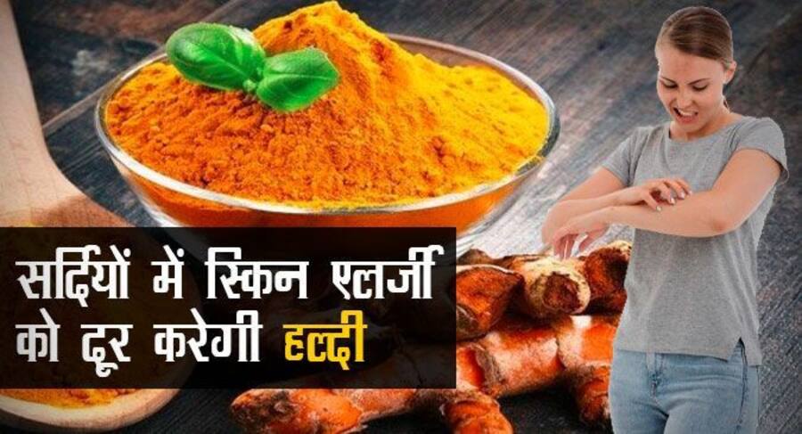 Turmeric Benefits for Skin Allergy: इन 2 तरीकों से करेंगे हल्दी का सेवन ...