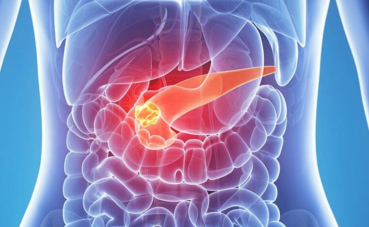 Rare types of cancer and their symptoms you should know | TheHealthSite.com