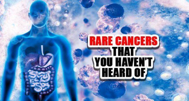 Rare Types Of Cancer And Their Symptoms You Should Know rare-types-of-cancer-and-their-symptoms-you-should-know