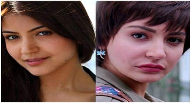 Anushka sharma lip job surgery : जब अनुष्का शर्मा को लोग बुलाने लगे ...