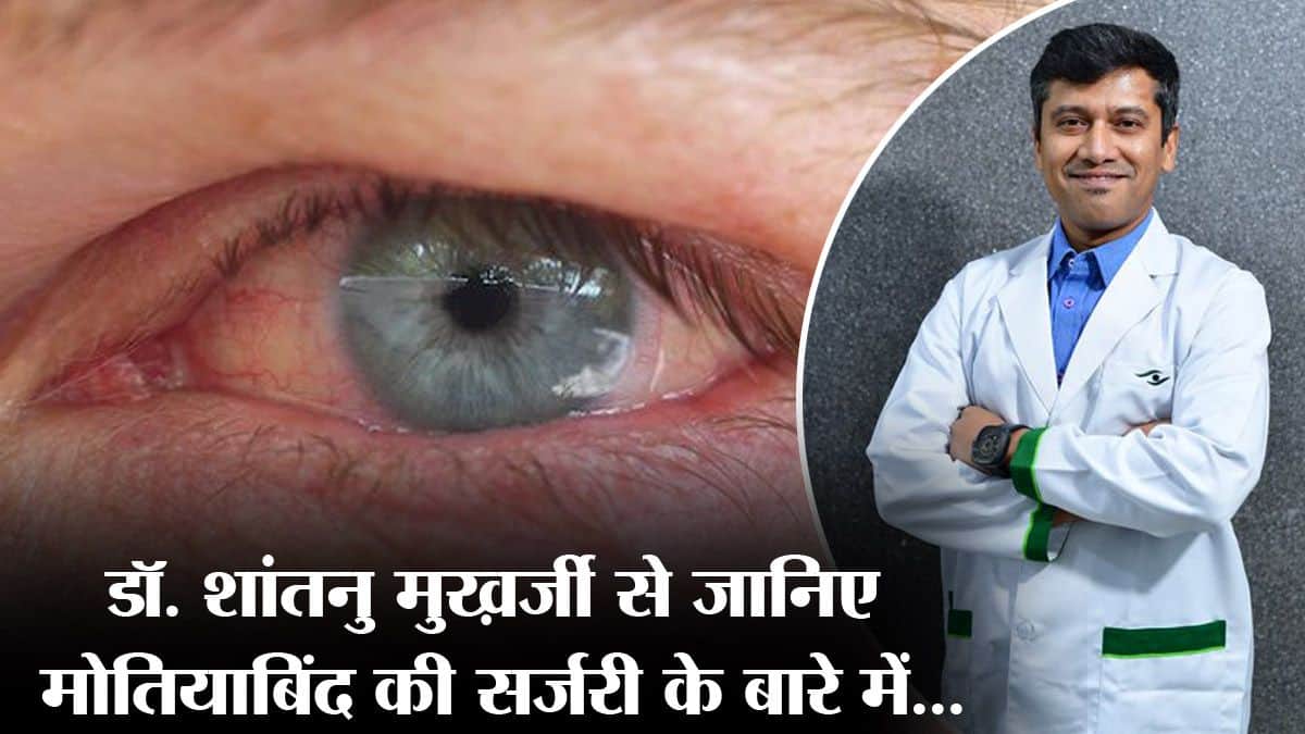 Cataract Surgery In Hindi | मोतियाबिंद की सर्जरी कब और किस मौसम में ...