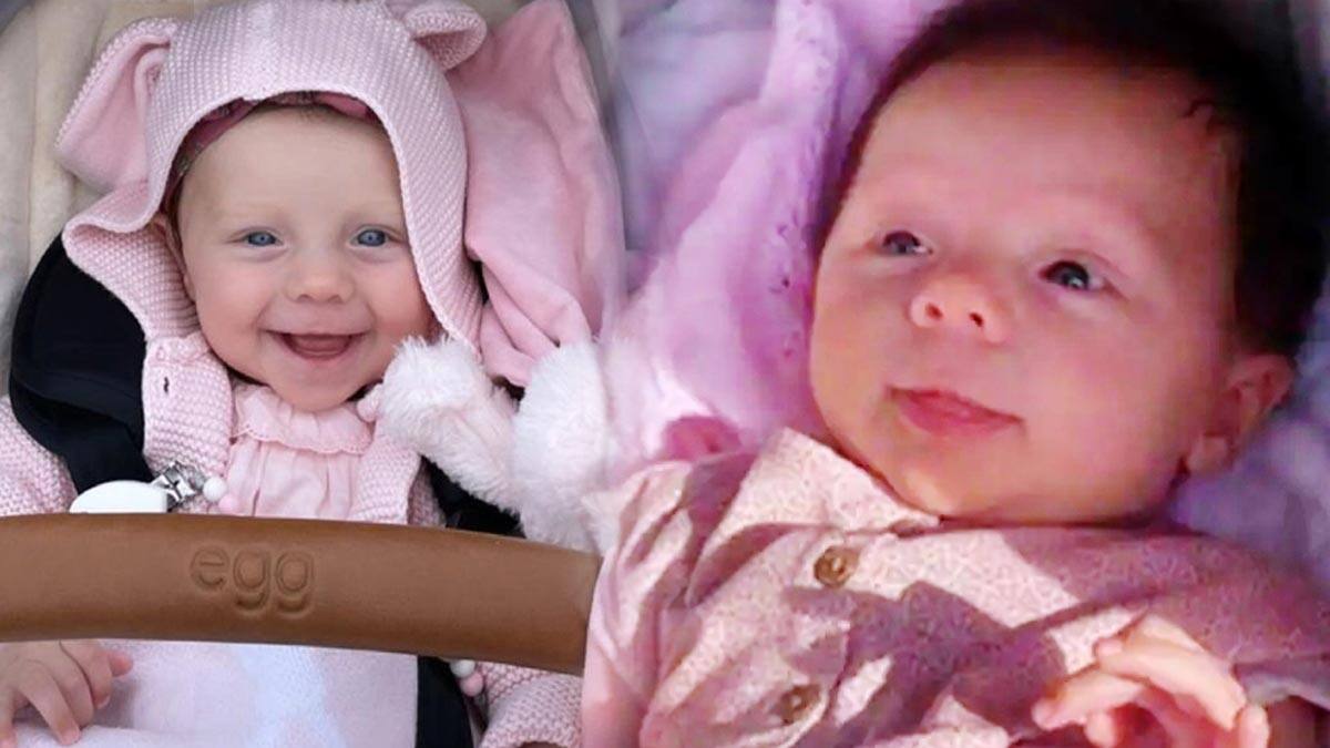 5-Month-Old Baby Turning To Stone Due To Rare Genetic Disease; Know ...