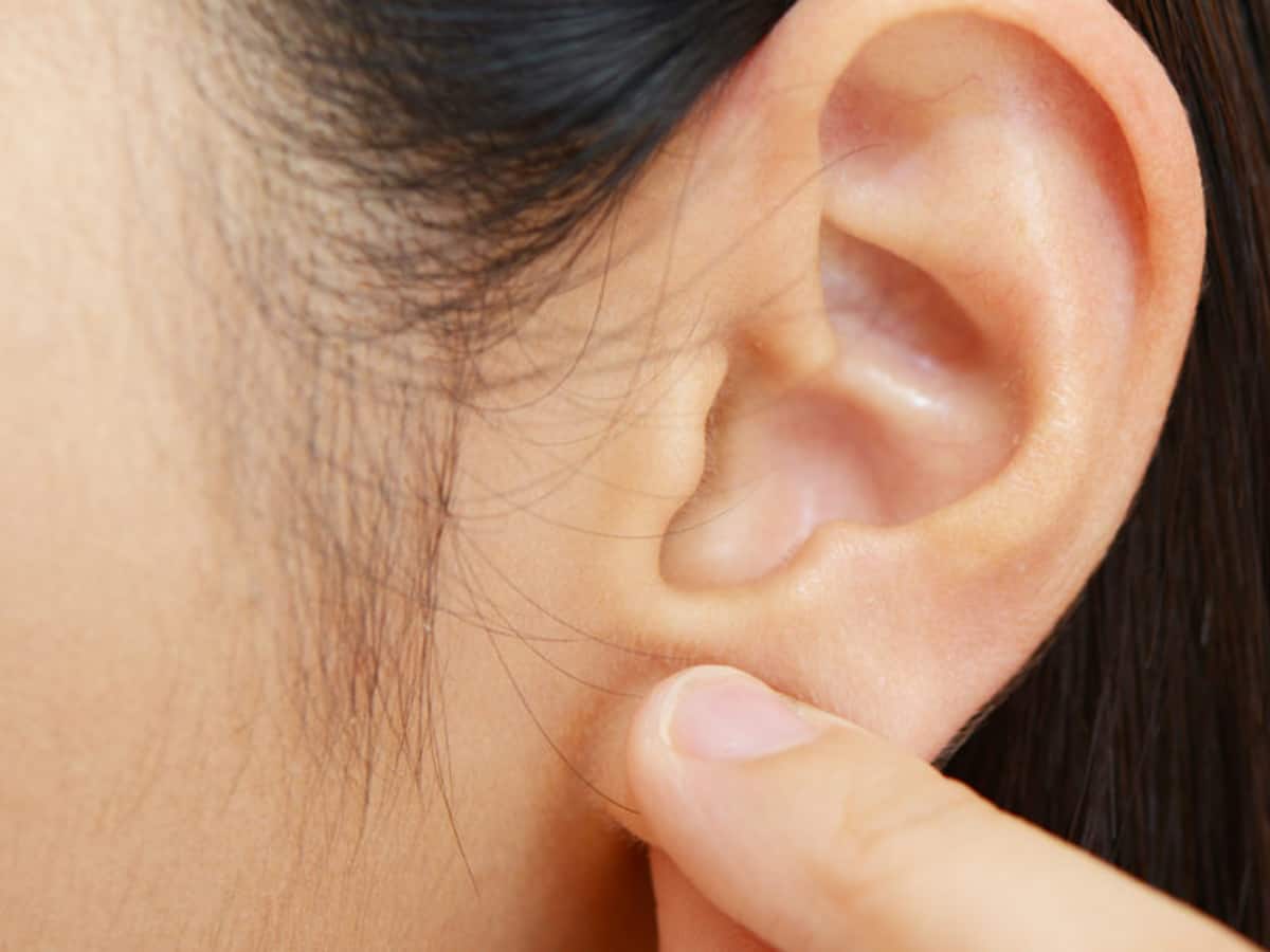 Face Mapping: What Your Acne Is Telling You About Your Health ...