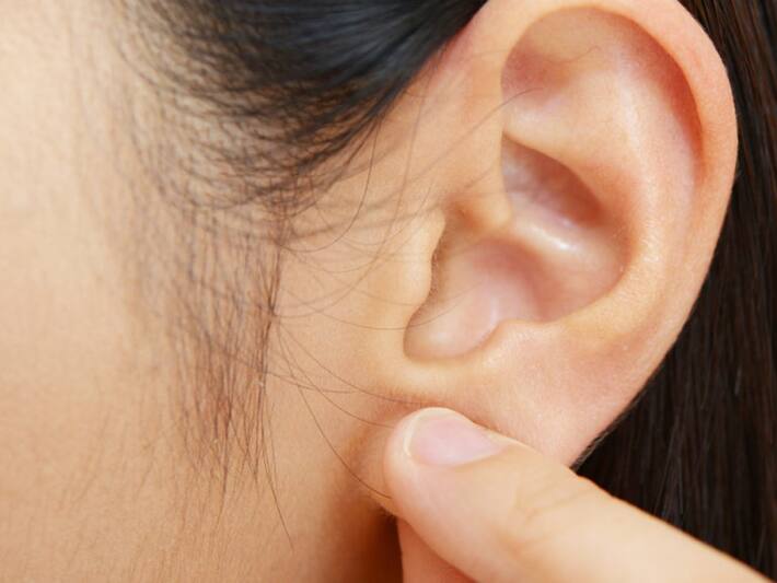 Face Mapping: What Your Acne Is Telling You About Your Health ...