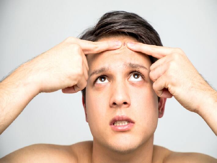 Face Mapping: What Your Acne Is Telling You About Your Health ...