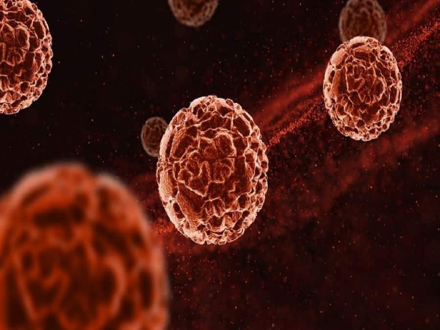 Decoding Cancer: Grades, Stages And More | TheHealthSite.com