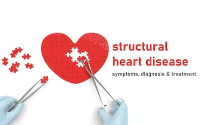Structural Heart Disease: Risk Factors, Types And Warning Signs To Know ...