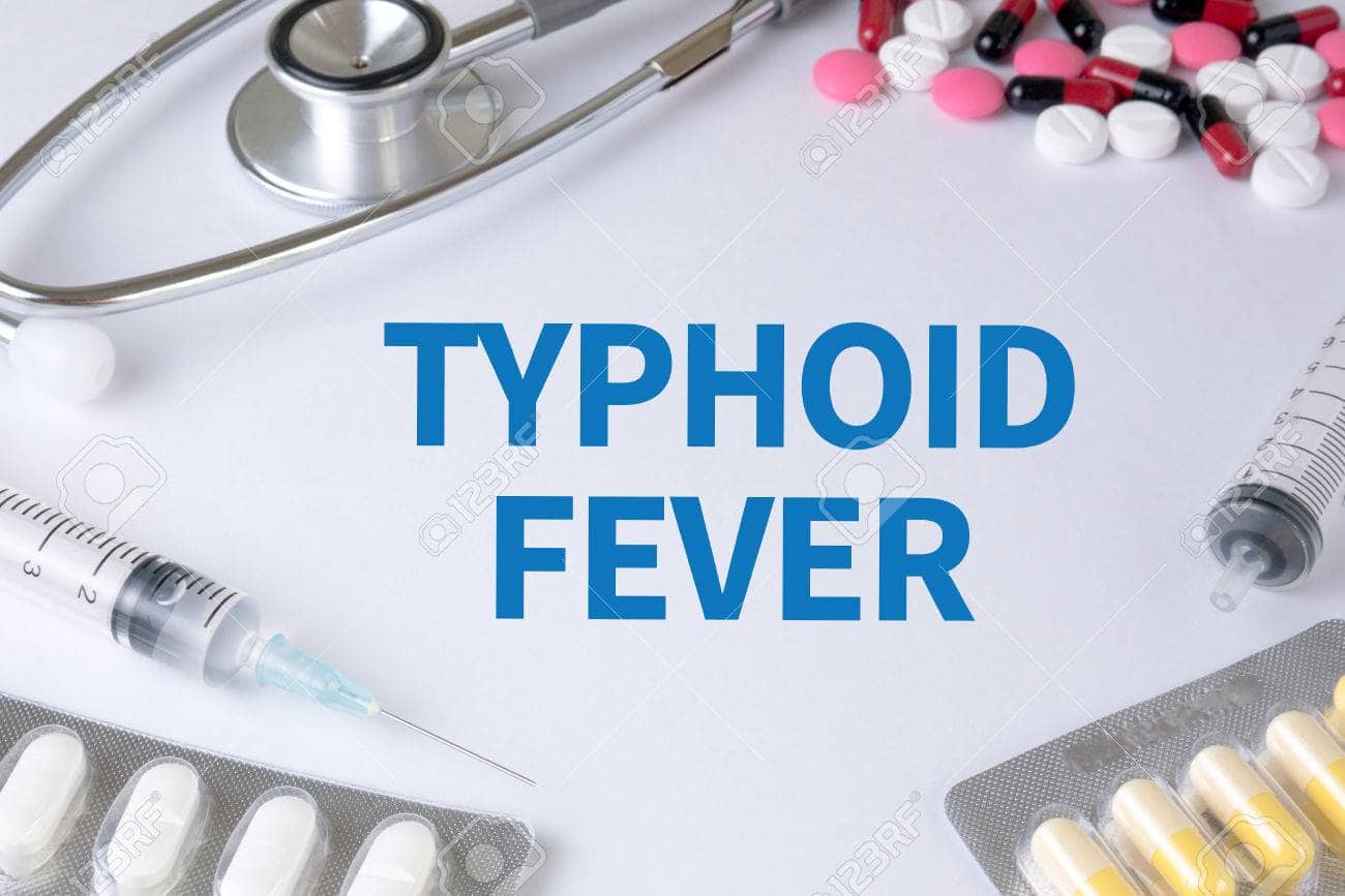 Typhoid Diet: Foods You Should Eat And Avoid When Suffering From ...